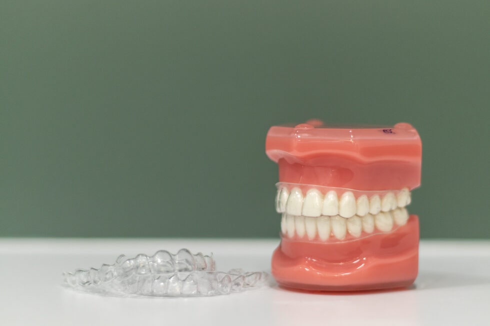 How Retainers Maintain Your New Smile After Aligners