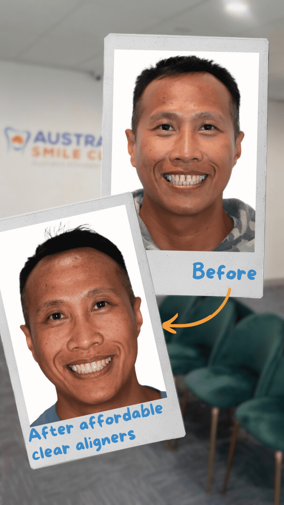 Invisible Braces | Clear aligners | Australian Smile Clinics